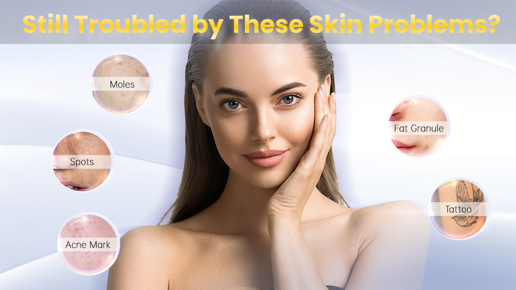 Beauty mark vs mole,are they similar?